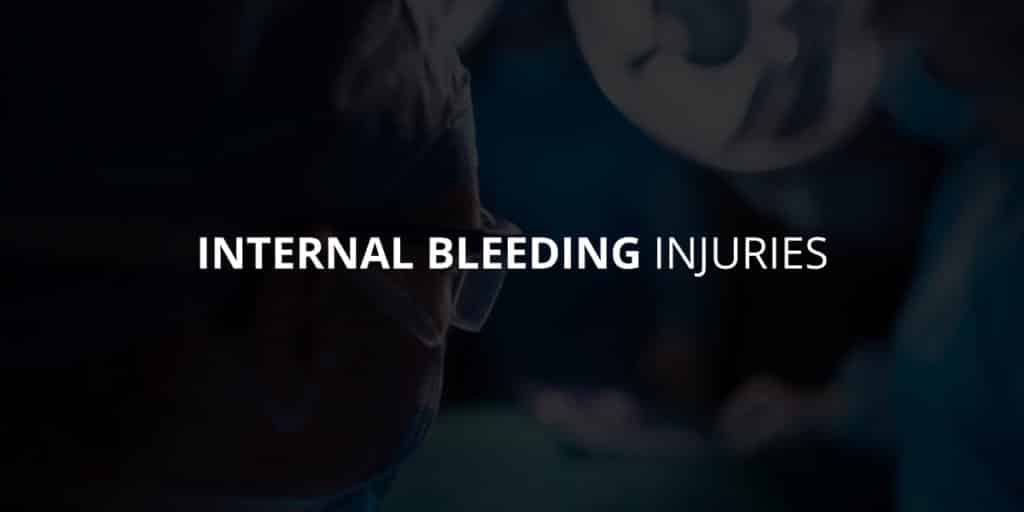Internal Bleeding Injuries | Siler & Ingber